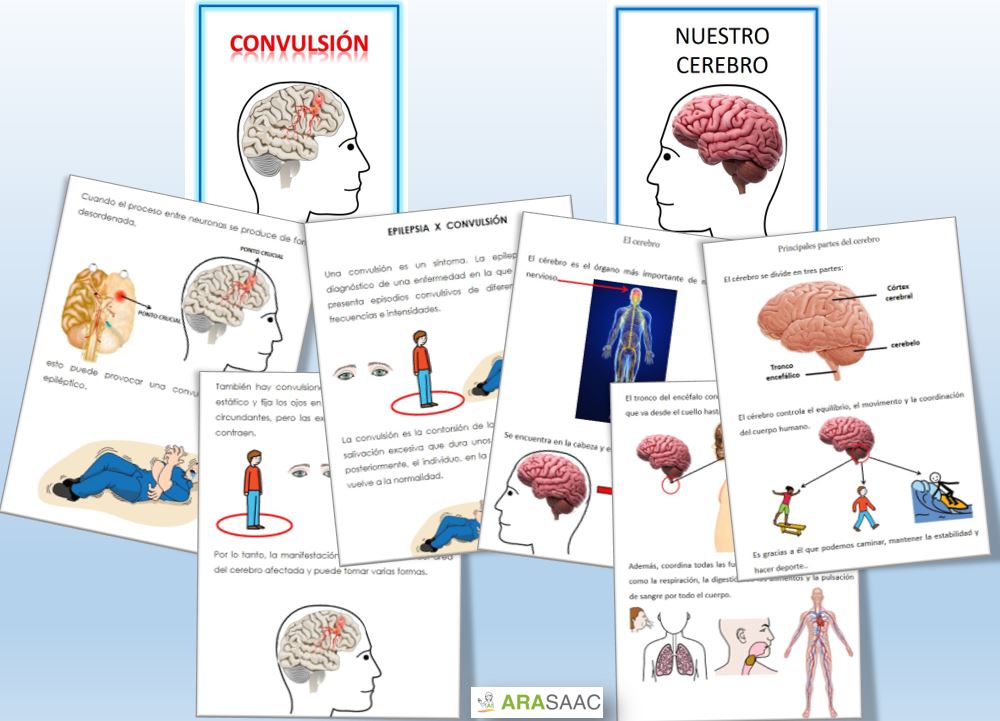 Unidad didáctica de biología : Nuestro cerebro y las convulsiones.